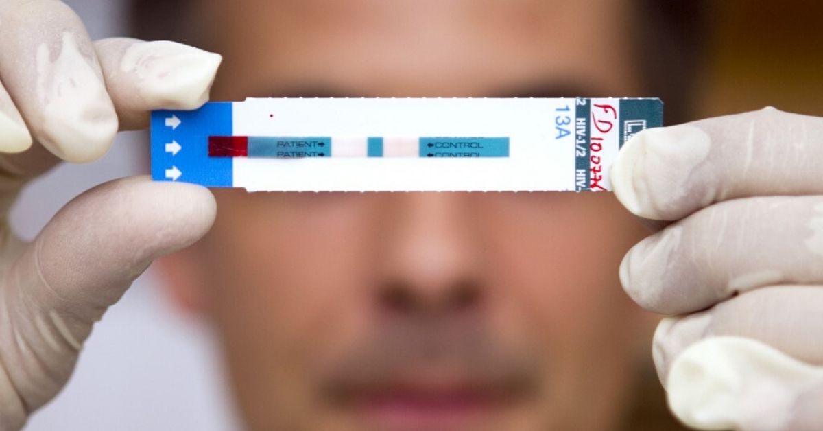 Paciente con sida se cura tras ser tratado solo con medicamentos