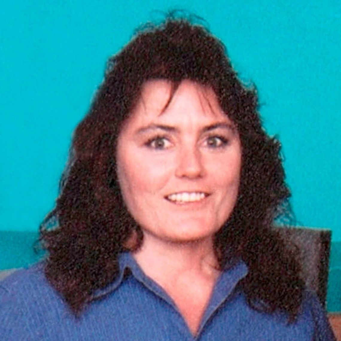 Murió Connie Culp, primera mujer en recibir trasplante de rostro en EE.UU.