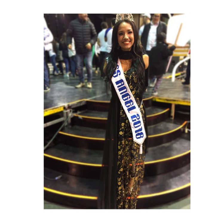 Alma inquebrantable: Influencer ecuatoriana perdió extremidades e inspira