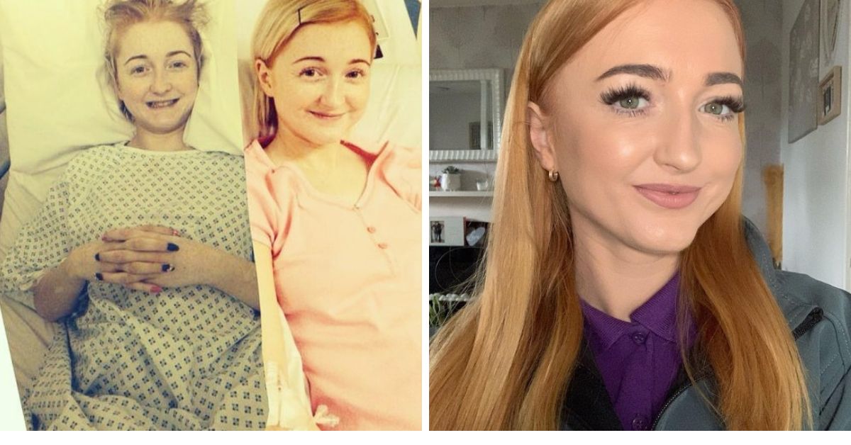 Una mujer pensó que tenía síntomas de estrés y era síndrome de Crohn